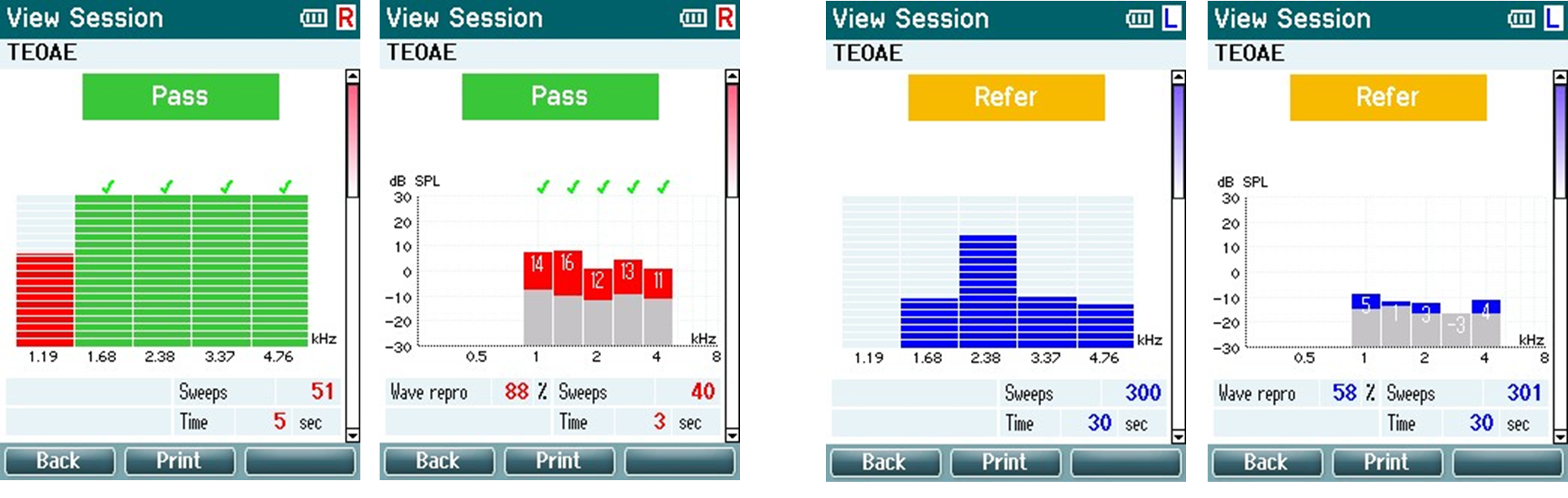 Titan | TEOAE Handheld | Interacoustics